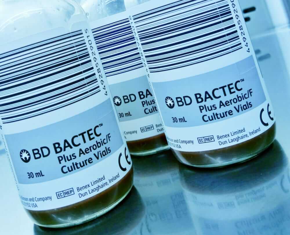 Earnings Preview: What to Expect From Becton, Dickinson and Company's Report